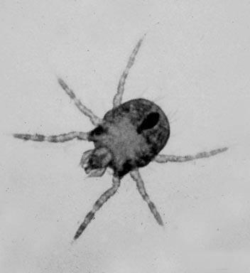 Chiggers | University of Maryland Extension