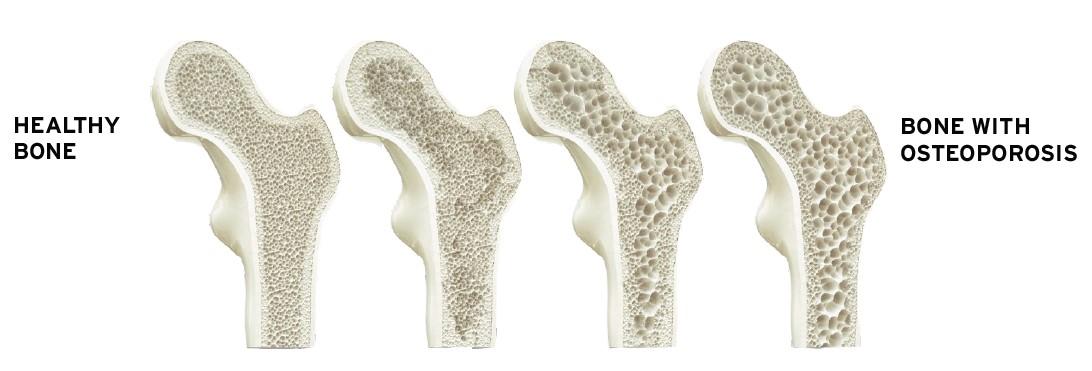 Better Bone Health for Older Adults (FS-2023-0669) | University of ...